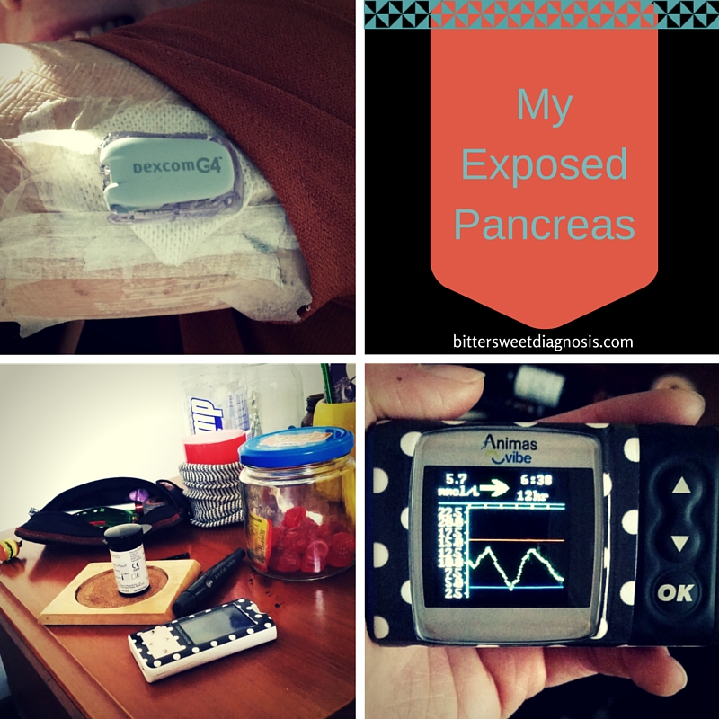 My Exposed Pancreas – Dr Ashley Ng