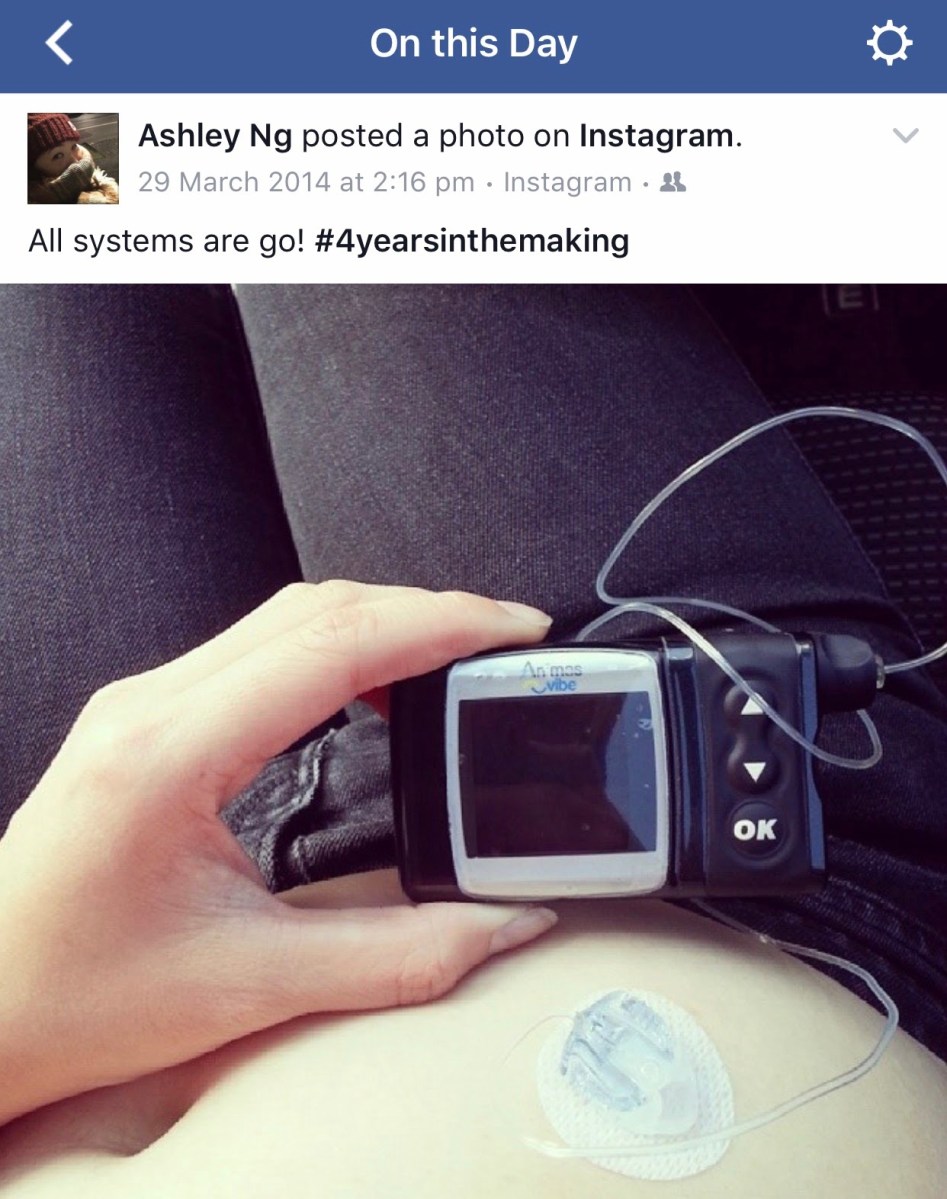 Pumpversary – Dr Ashley Ng